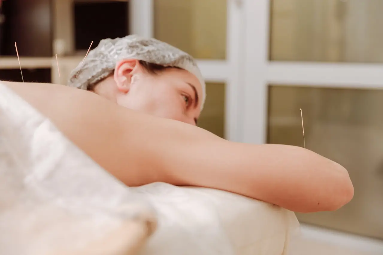 Can Acupuncture Help With Panic Attacks?
