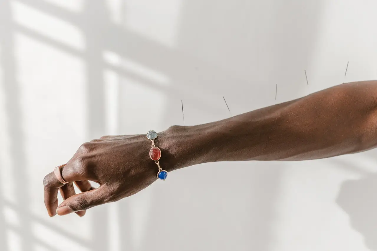 How Long Does It Take Dry Needling To Work?